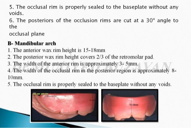 The occlusal rims and record