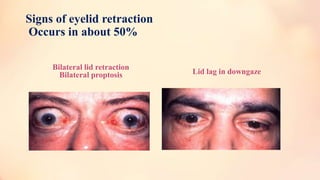 The ocular presentation of systemic diseases | PPTX