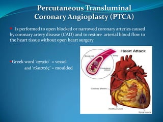 Percutaneous Transluminal Coronary Angioplasty (ptca)