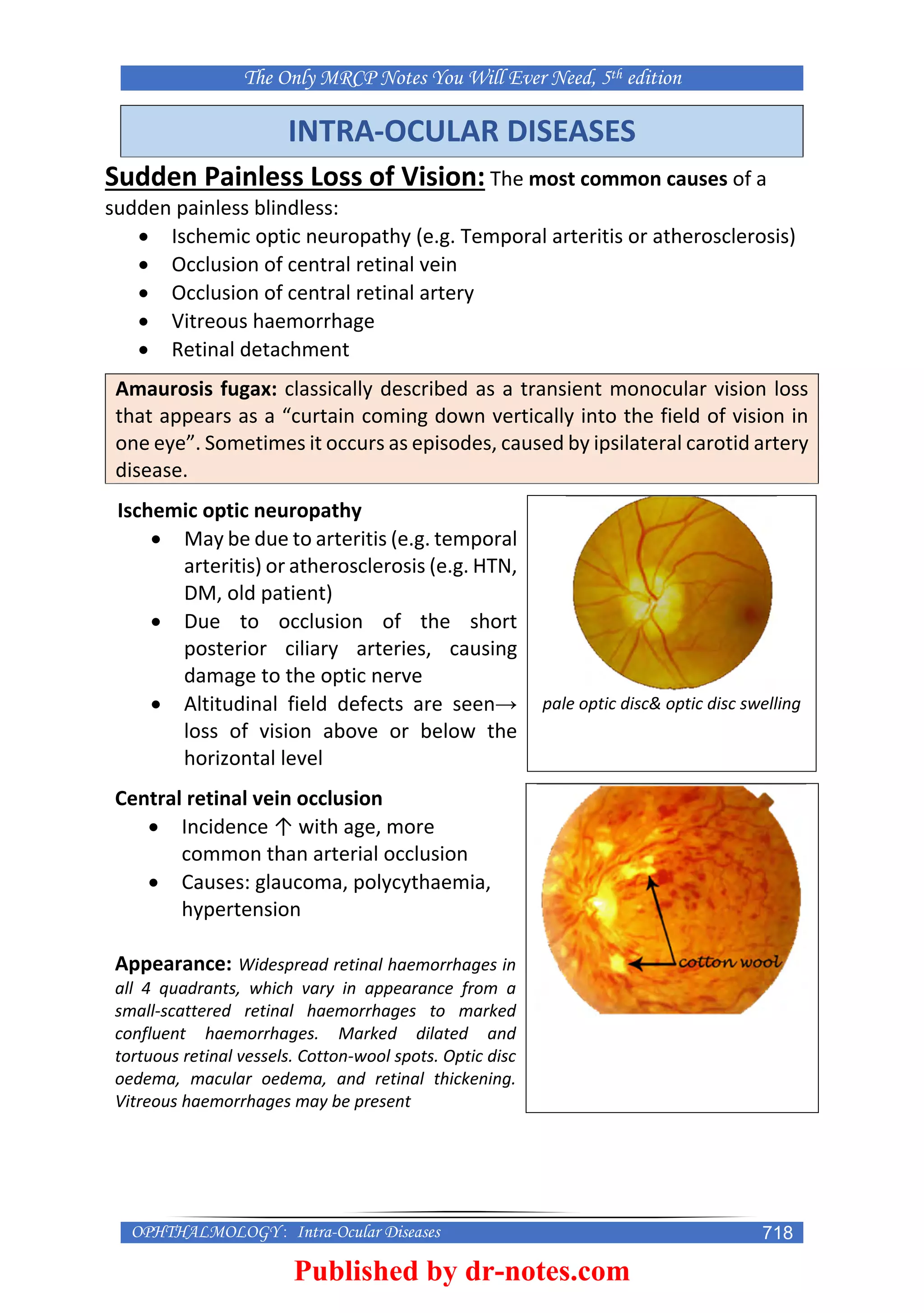 The Only MRCP Notes You Will Ever Need 5th Edition | PDF