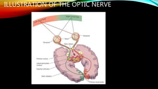 THE OPTIC NERVE | PPTX