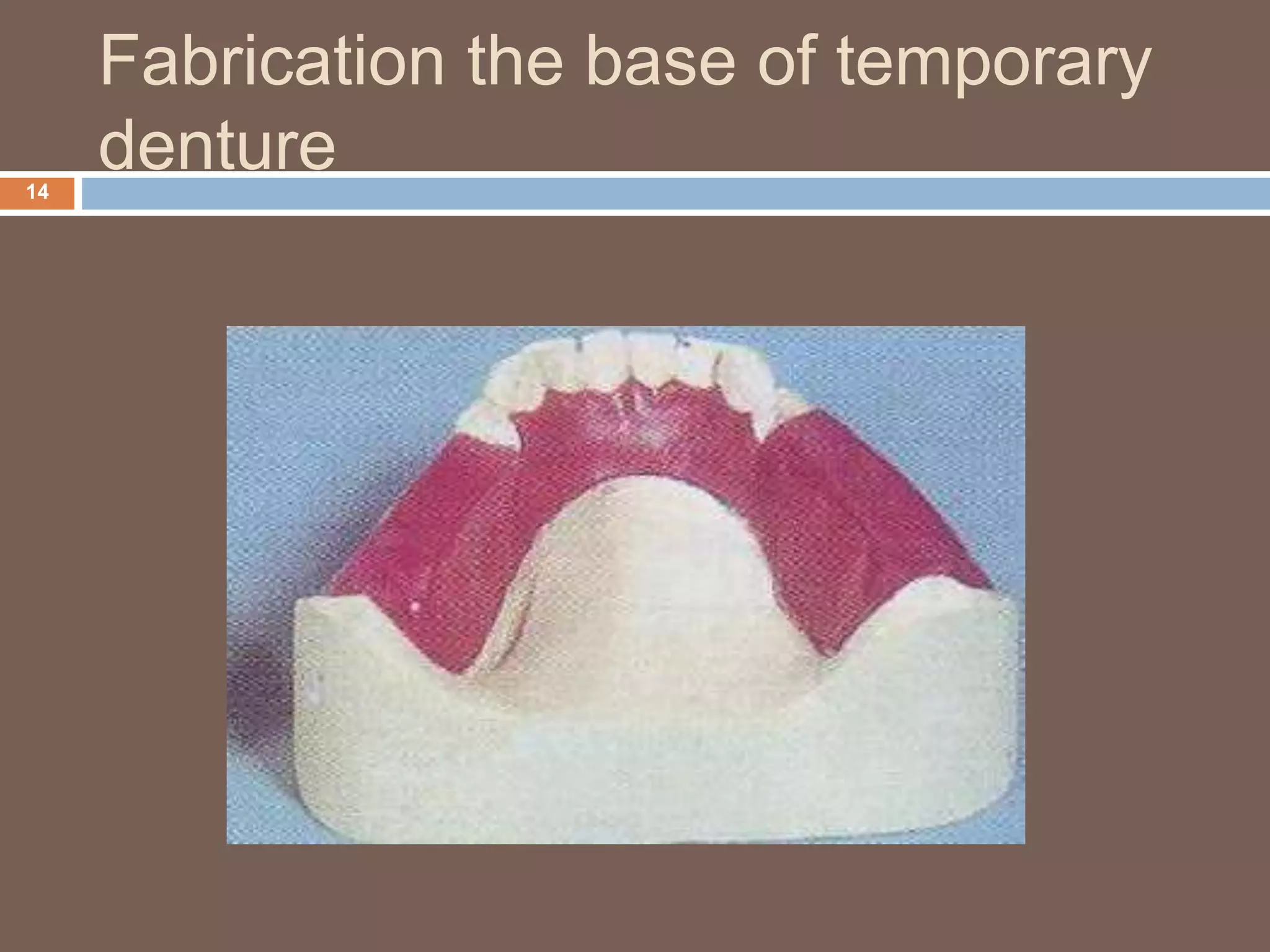 Acrylic type temporary Removable Partial Denture Steps | PPTX