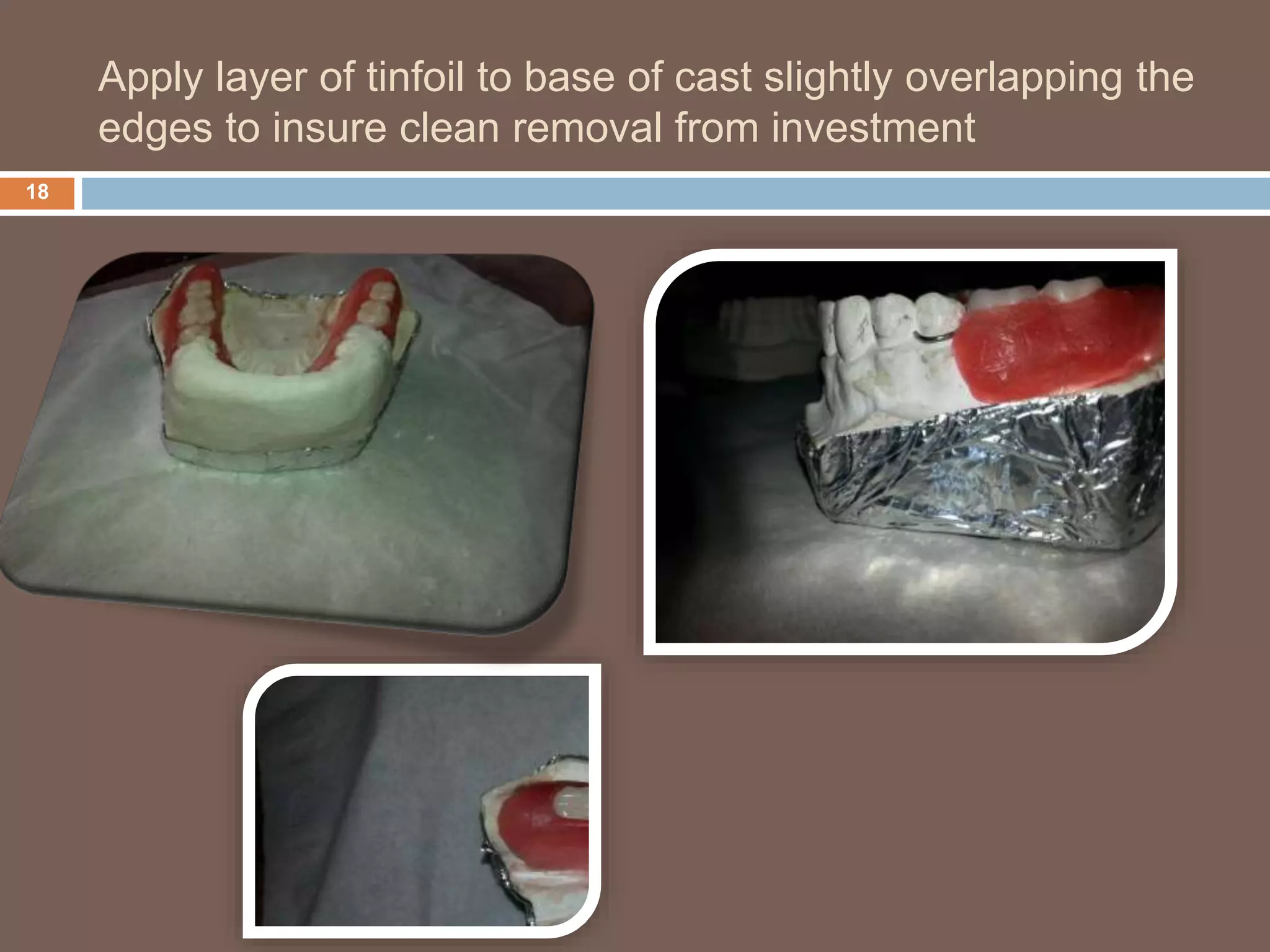 Acrylic type temporary Removable Partial Denture Steps | PPTX