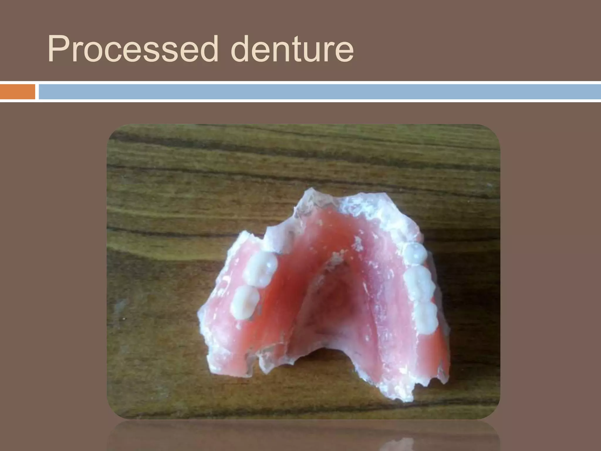 Acrylic type temporary Removable Partial Denture Steps | PPTX