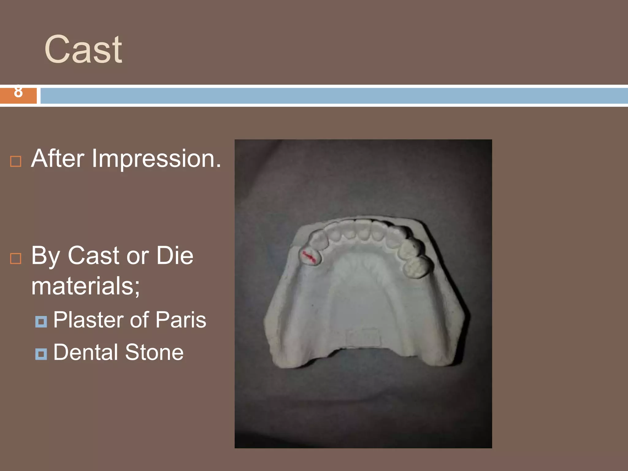 Acrylic Type Temporary Removable Partial Denture Steps Pptx