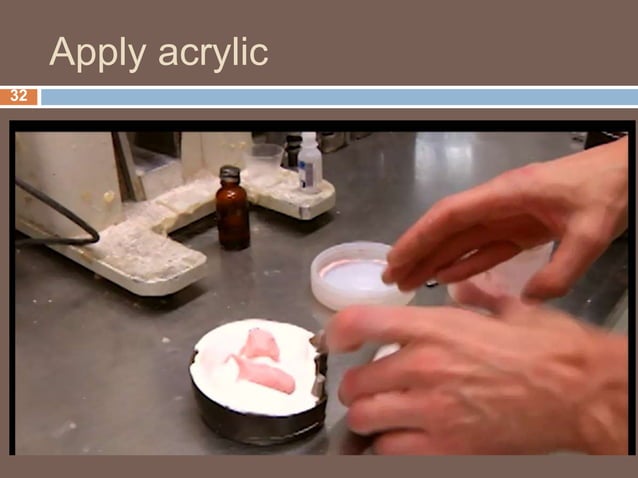 Acrylic type temporary Removable Partial Denture Steps | PPTX | Dental ...