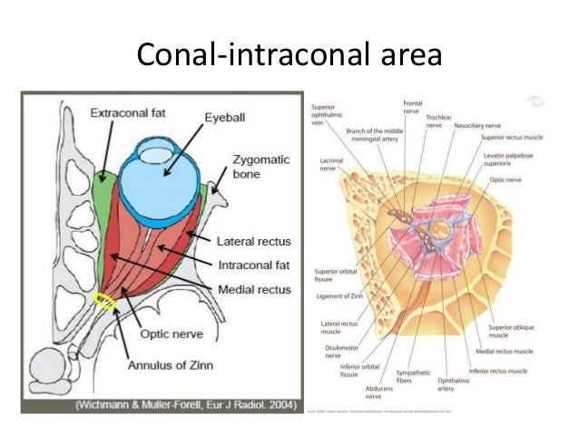 Orbit Imaging Anatomy