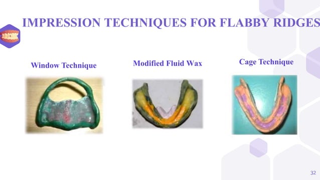 Theories of impression making | PPTX | Dental Health | Diseases and ...