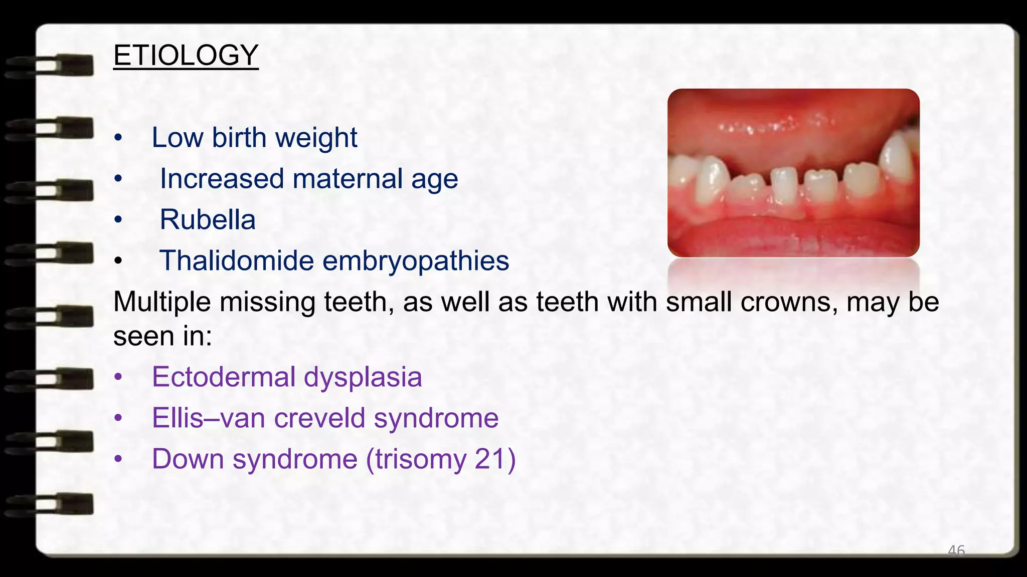 Theories and mechanism of eruption of primary and | PPTX