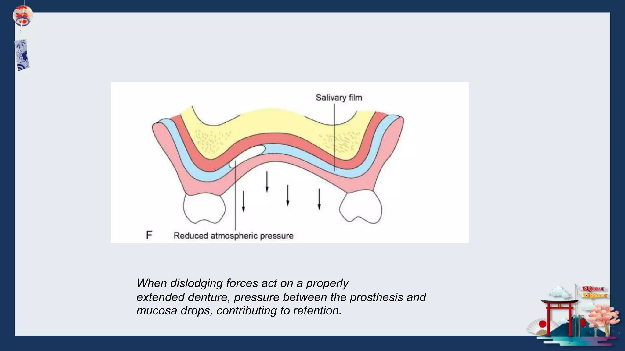 Theories, objectives and principals of impression making in complete ...