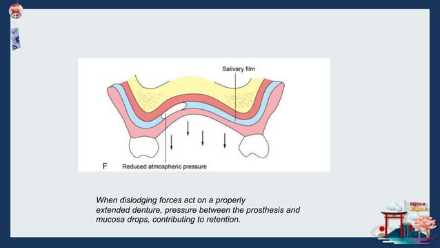 Theories, objectives and principals of impression making in complete ...