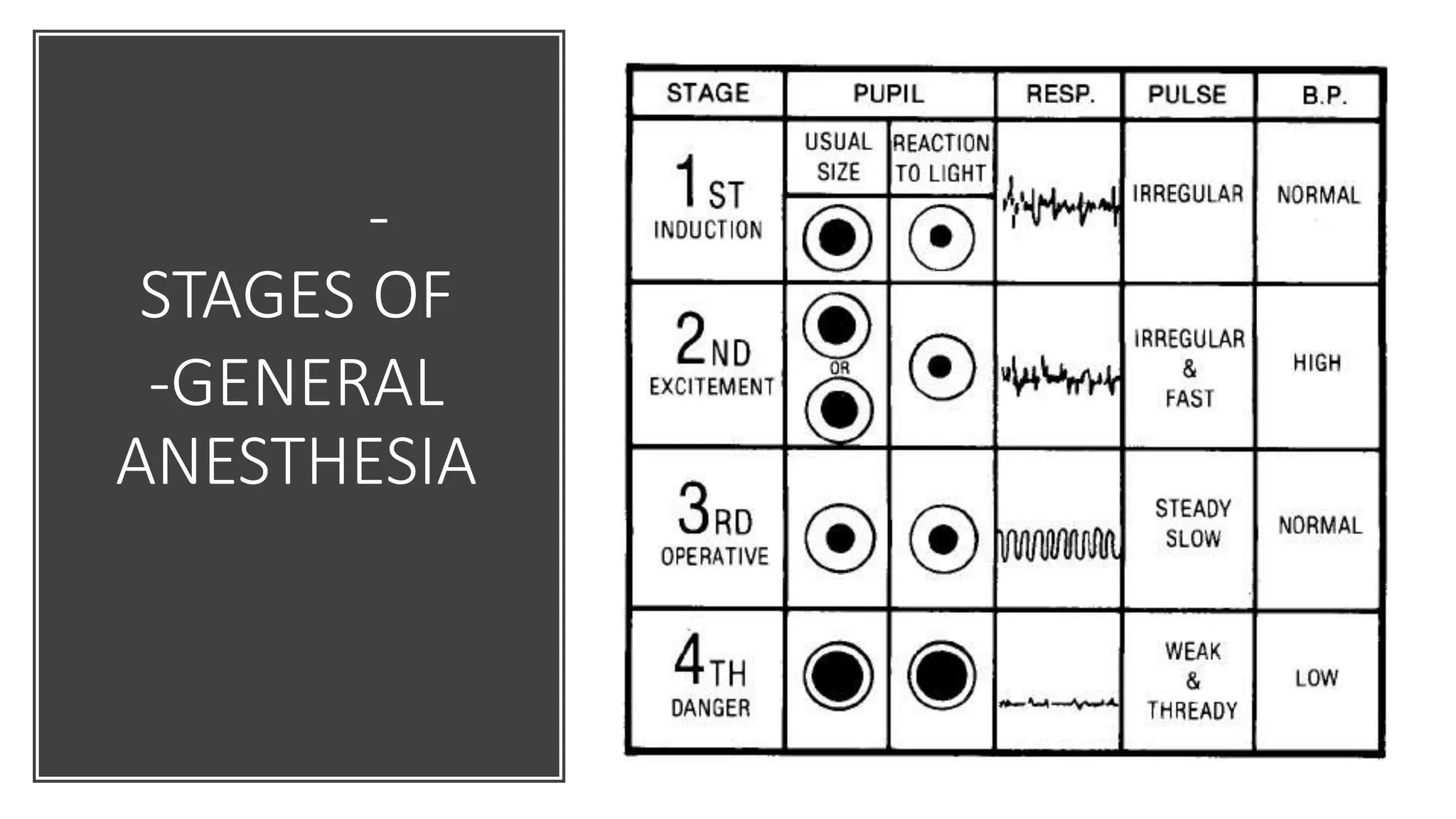 Theories of anesthesia | PPTX