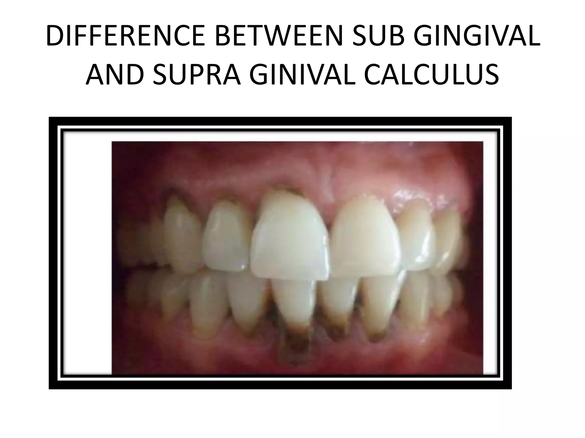 Theories of calculus formation.pptx