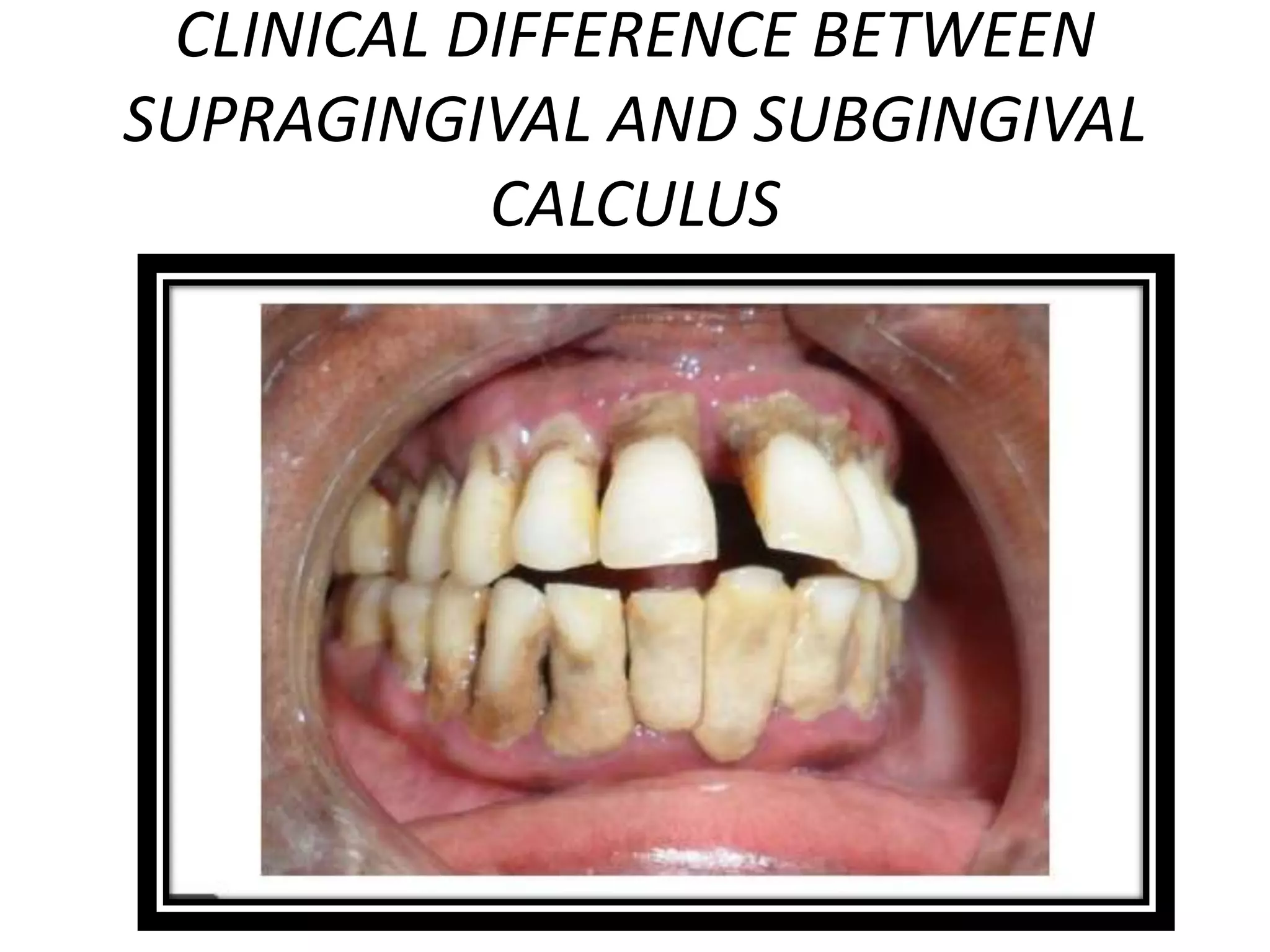Theories of calculus formation.pptx