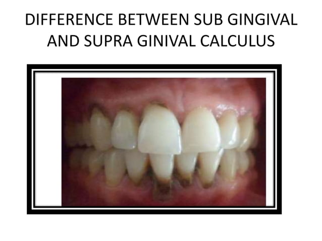 Theories of calculus formation.pptx