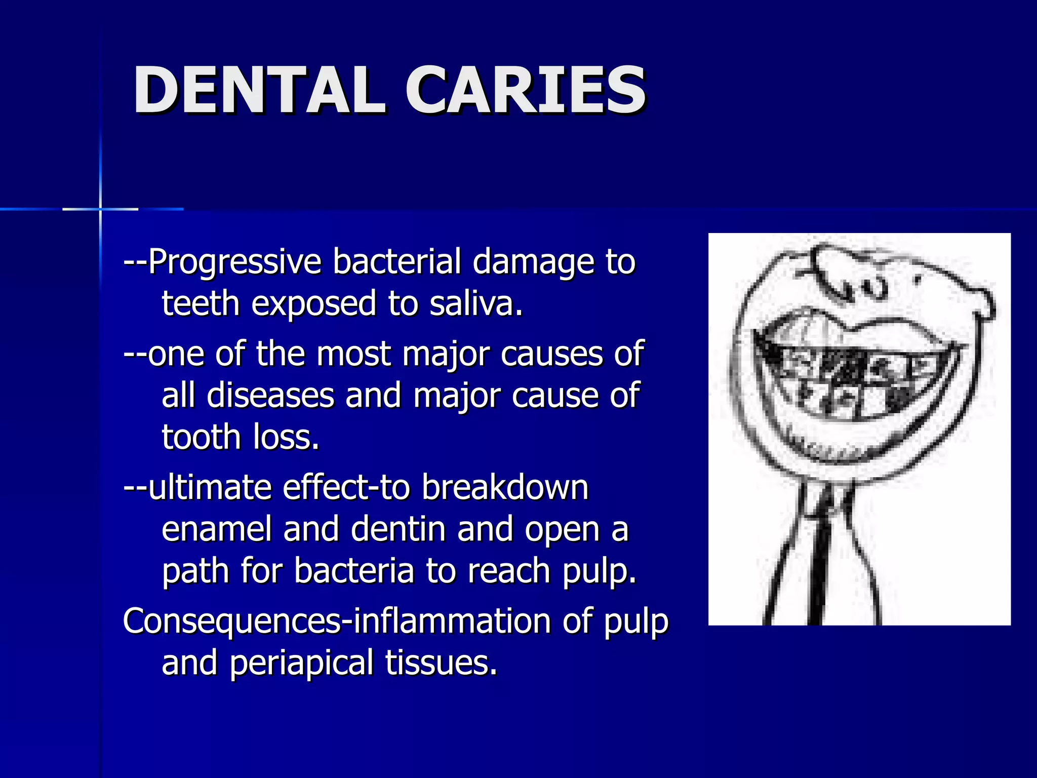 Theories of dental caries.ppt | PPT