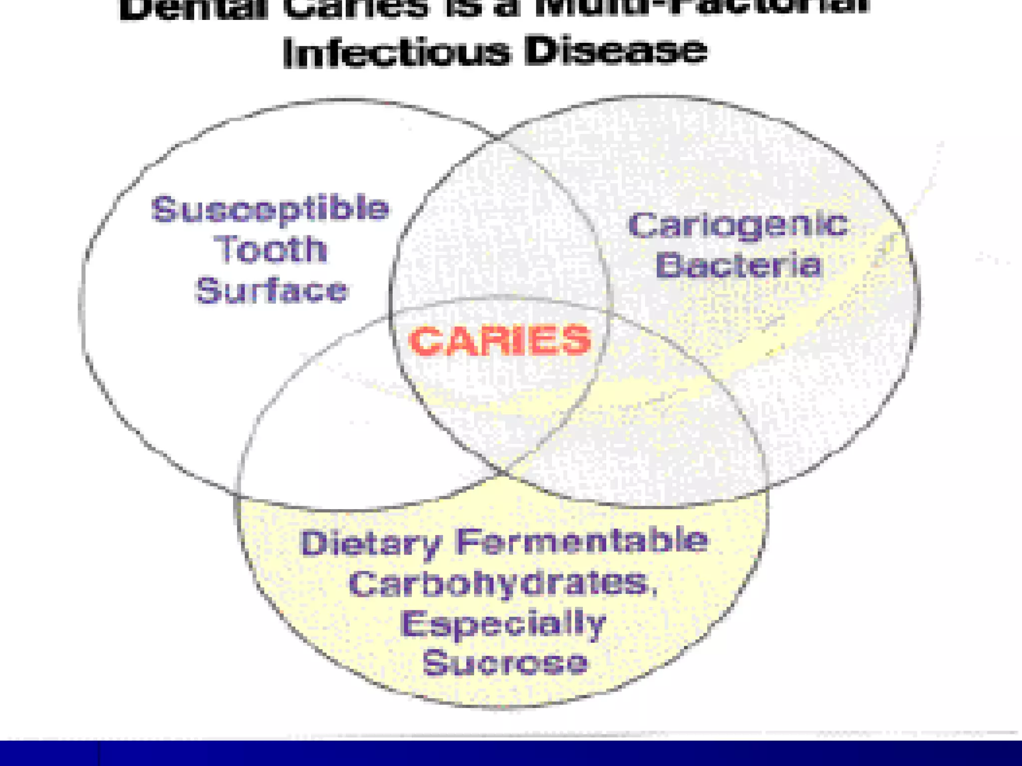 Theories of dental caries.ppt | PPT