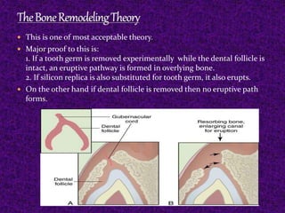 THEORIES OF TOOTH ERUPTION | PPTX