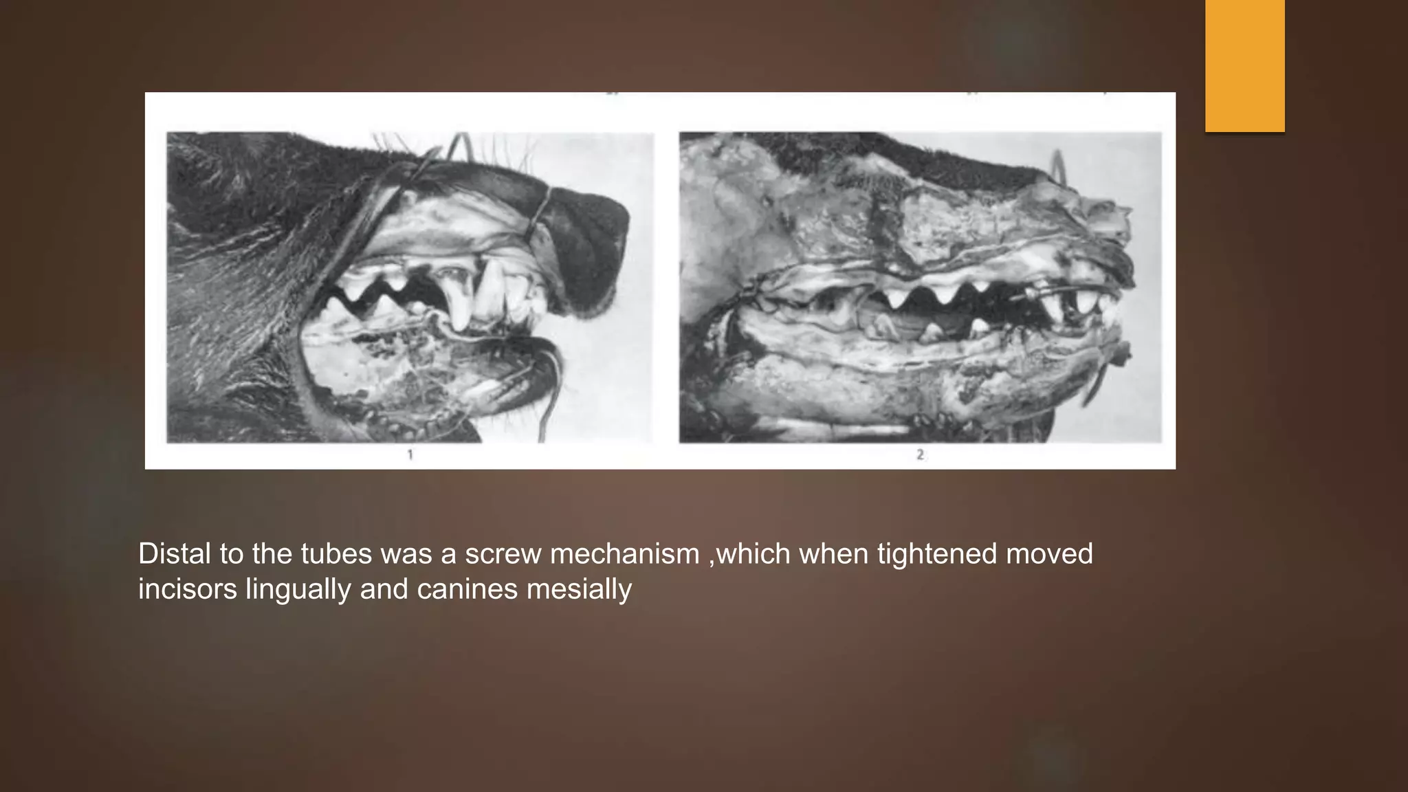 THEORIES OF TOOTH MOVEMENT.pptx