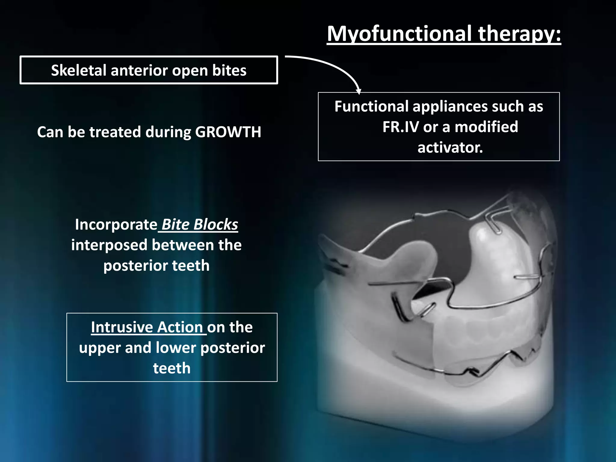 Management of Open Bite - Dr. Nabil Al-Zubair | PDF