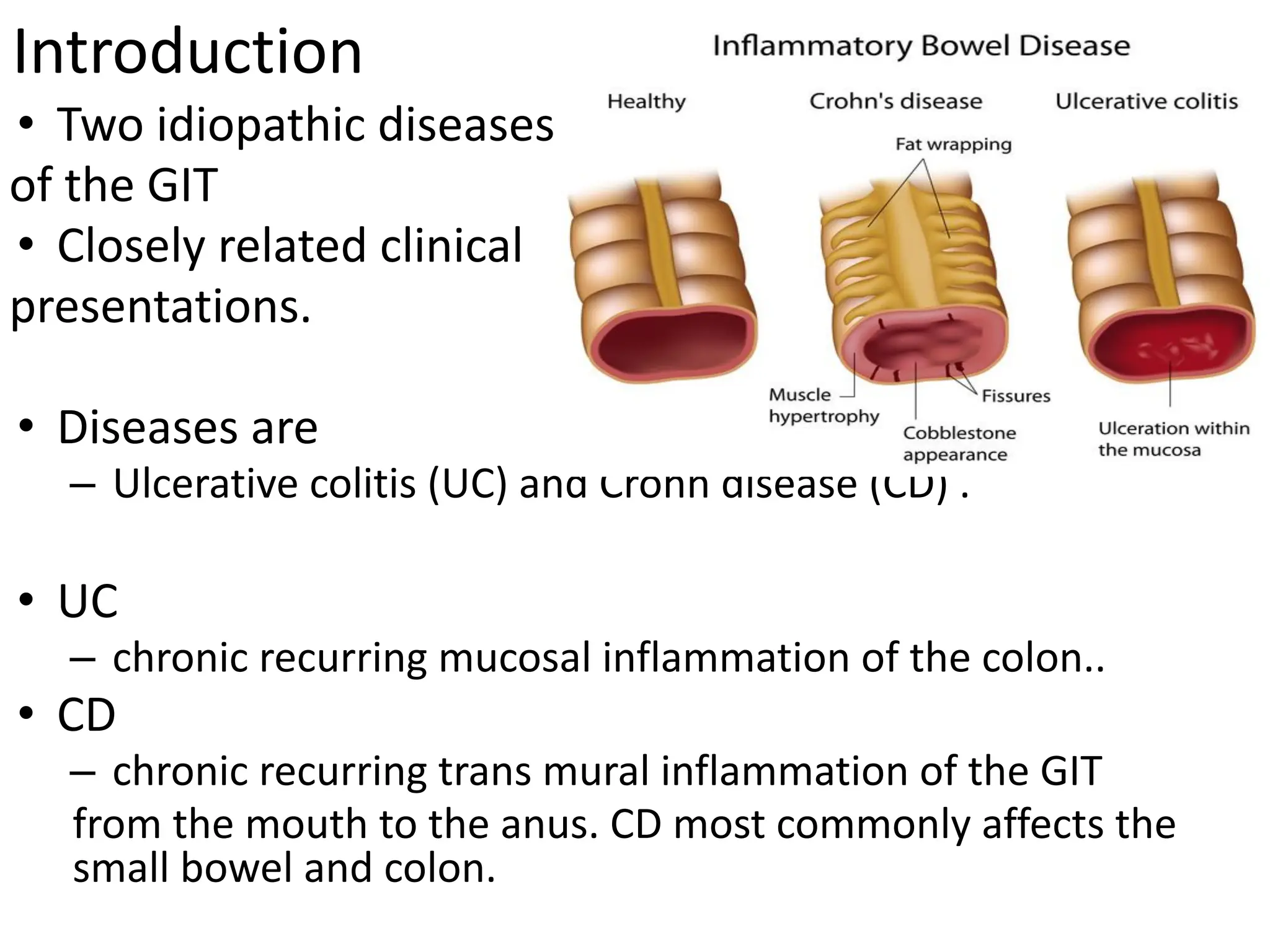 Irritable bowel disease/syndrome | PDF