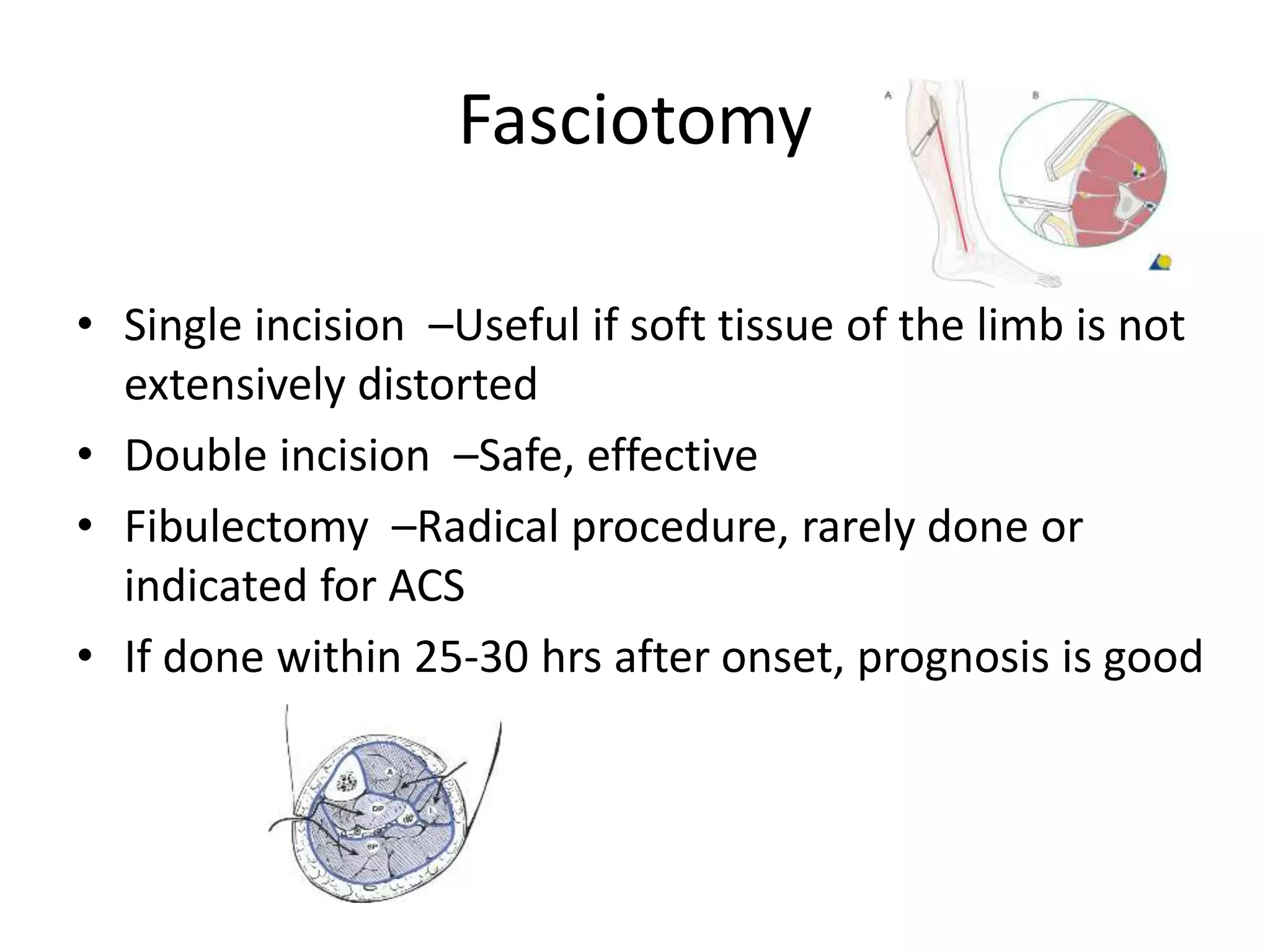 COMPARTMENT SYNDROME | PPTX