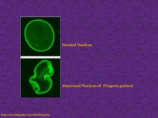 Theory of ageing | PPTX