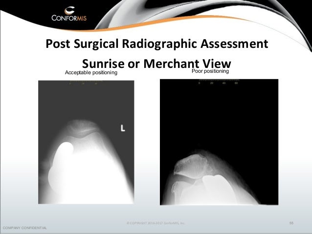 The osteoarthritic knee and hip 2016