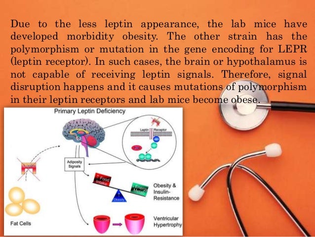 The overview of Leptin replacement therapy | PPTX