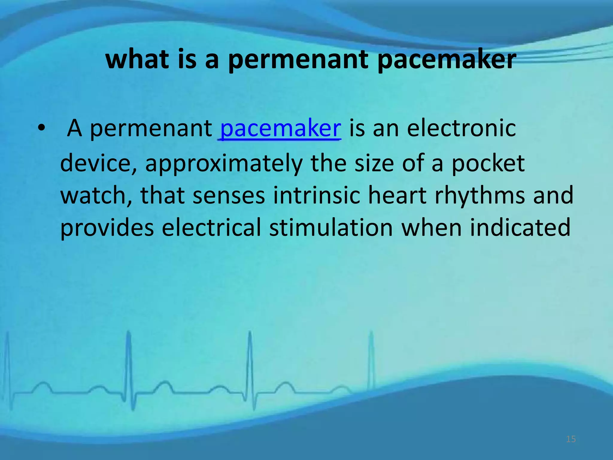 The pacemaker | PPTX