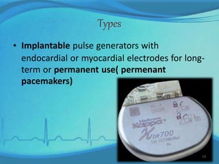 The pacemaker | PPTX