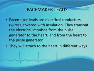 The pacemaker | PPTX