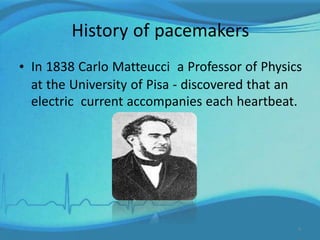 The pacemaker | PPTX