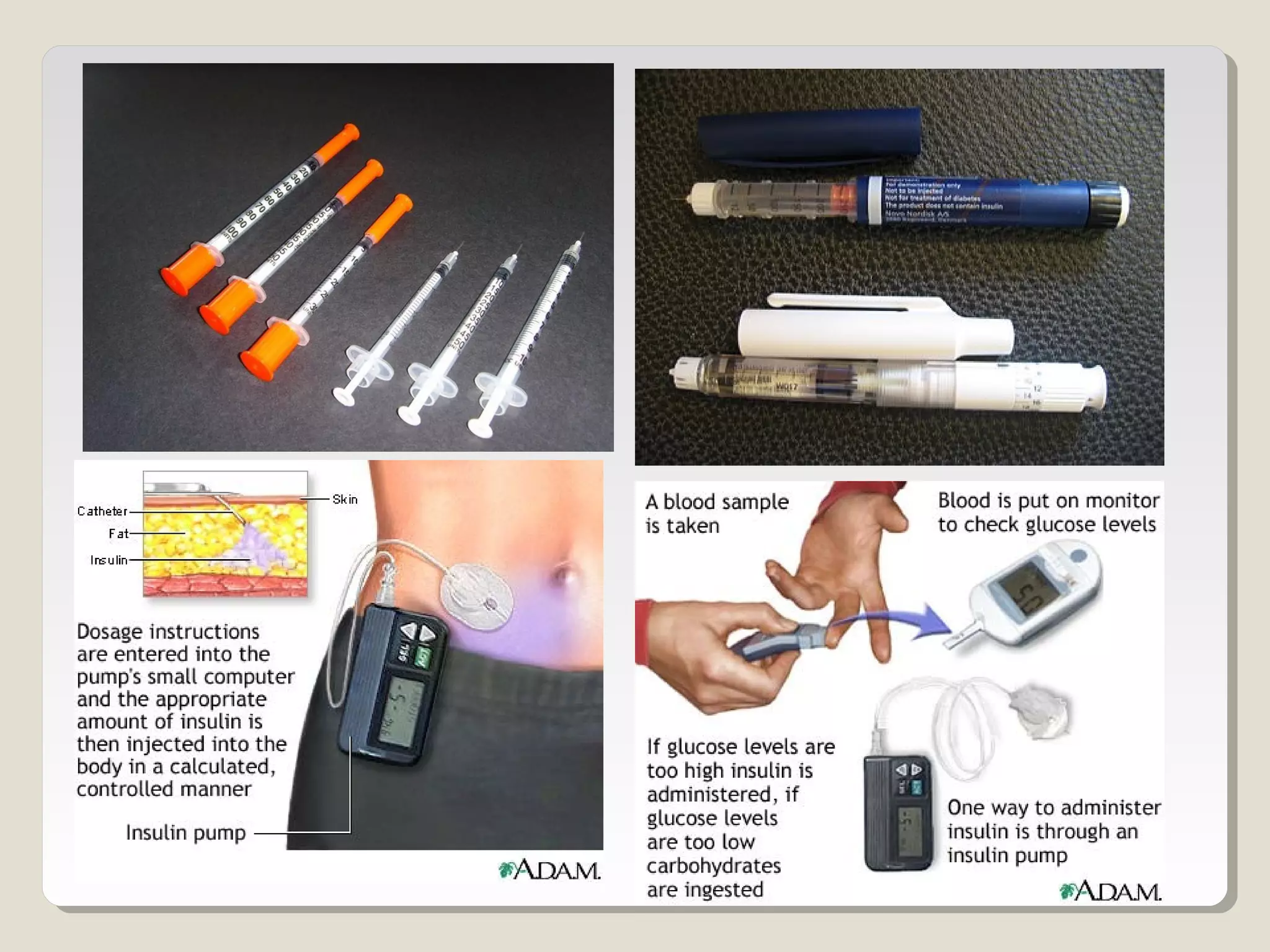 The pancreas and glucose homeostasis l4 | PPT