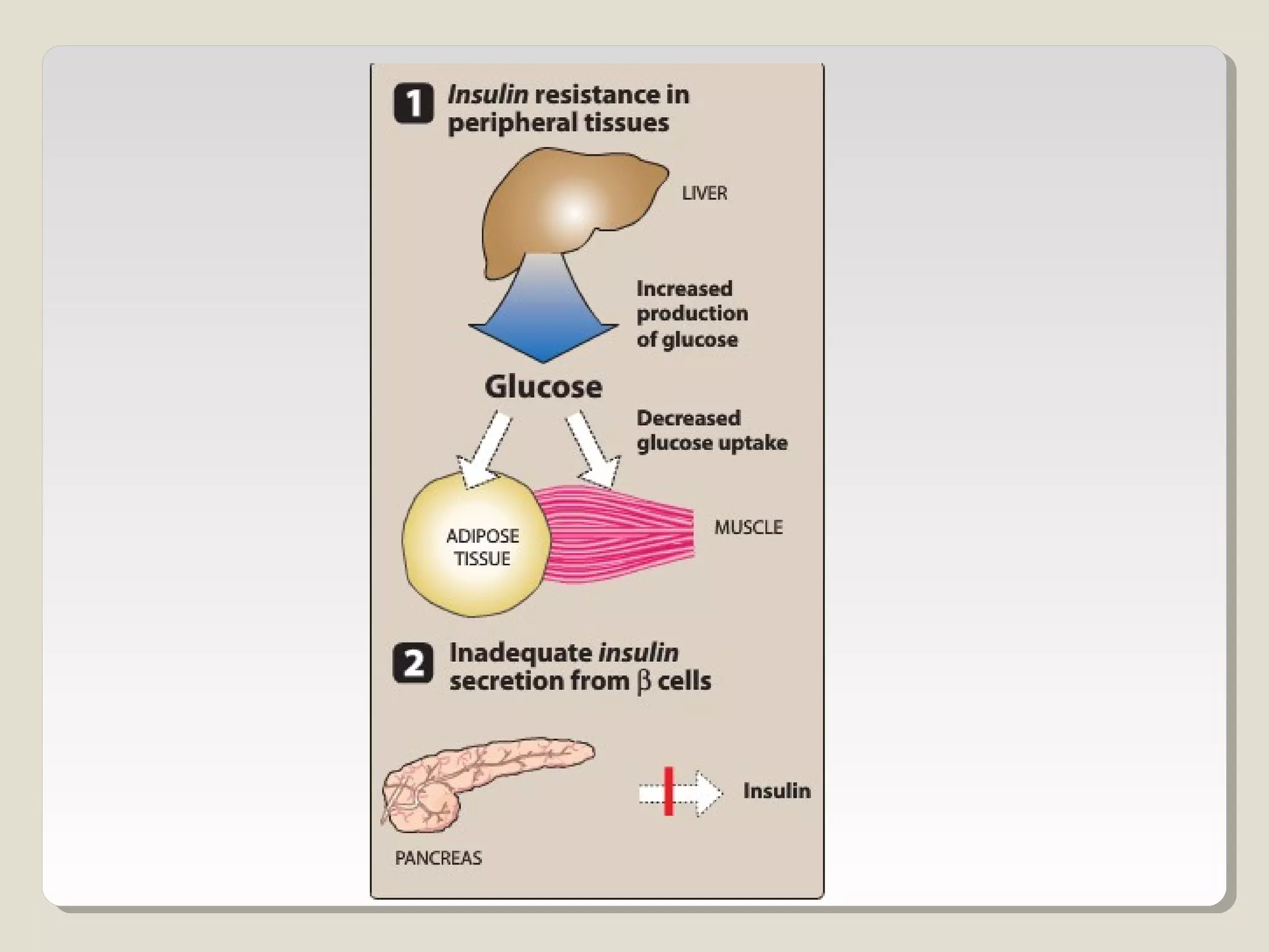 The pancreas and glucose homeostasis l4 | PPT