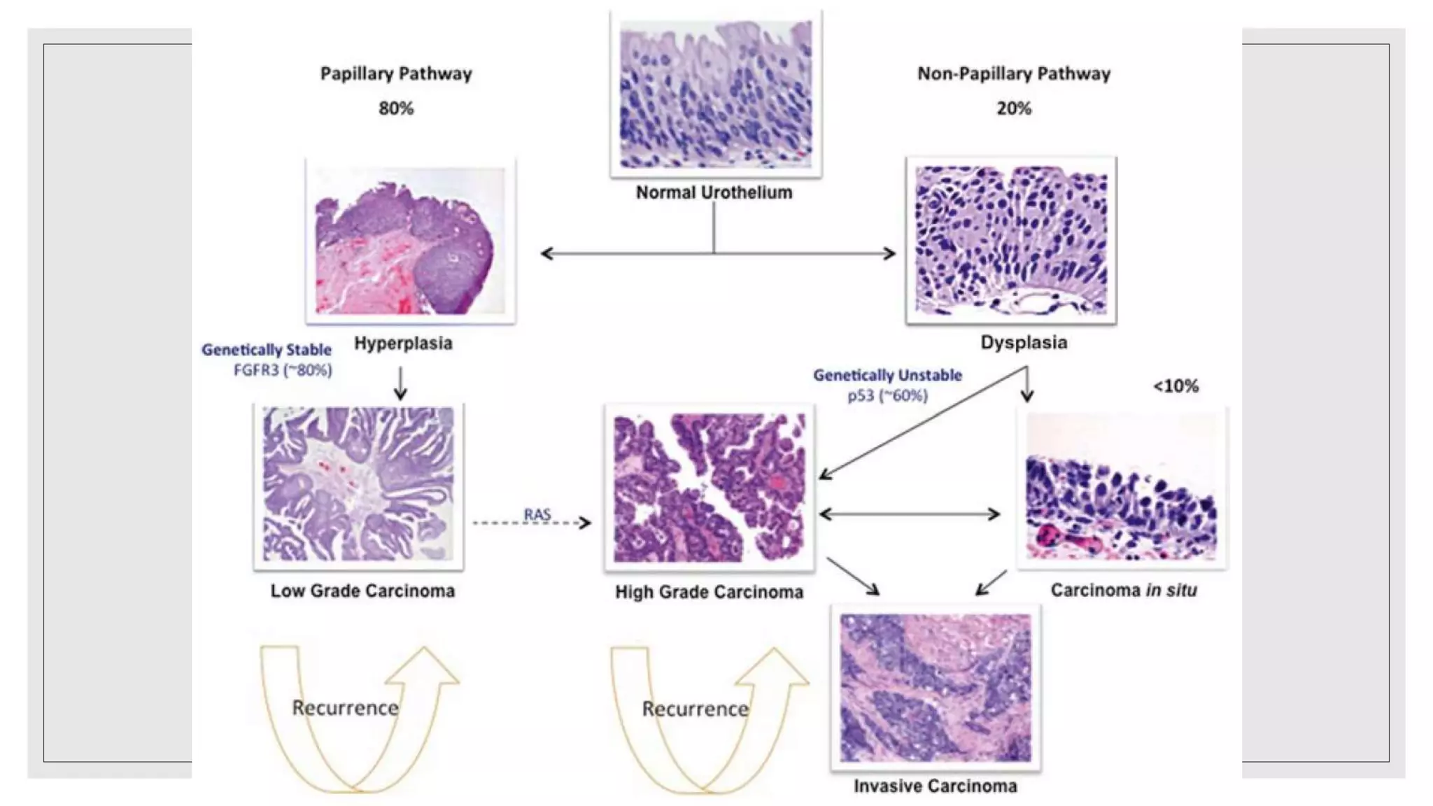 The Paris System for Reporting Urinary Cytology | PPTX