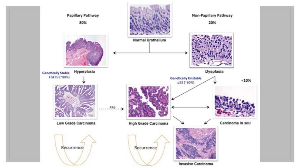 The Paris System for Reporting Urinary Cytology