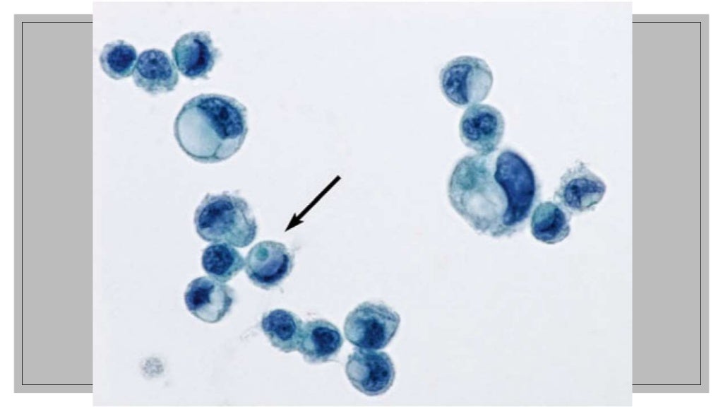 The Paris System for Reporting Urinary Cytology