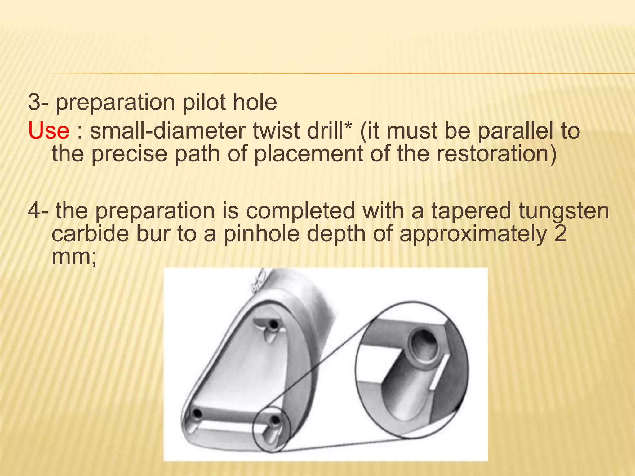 The partial veneer crown , inlay and onlay.pptx