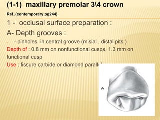 The partial veneer crown , inlay and onlay.pptx