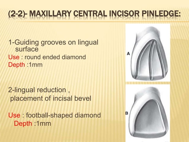 The partial veneer crown , inlay and onlay.pptx | Dental Health ...
