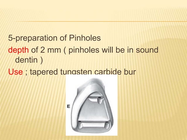 The partial veneer crown , inlay and onlay.pptx | Dental Health ...