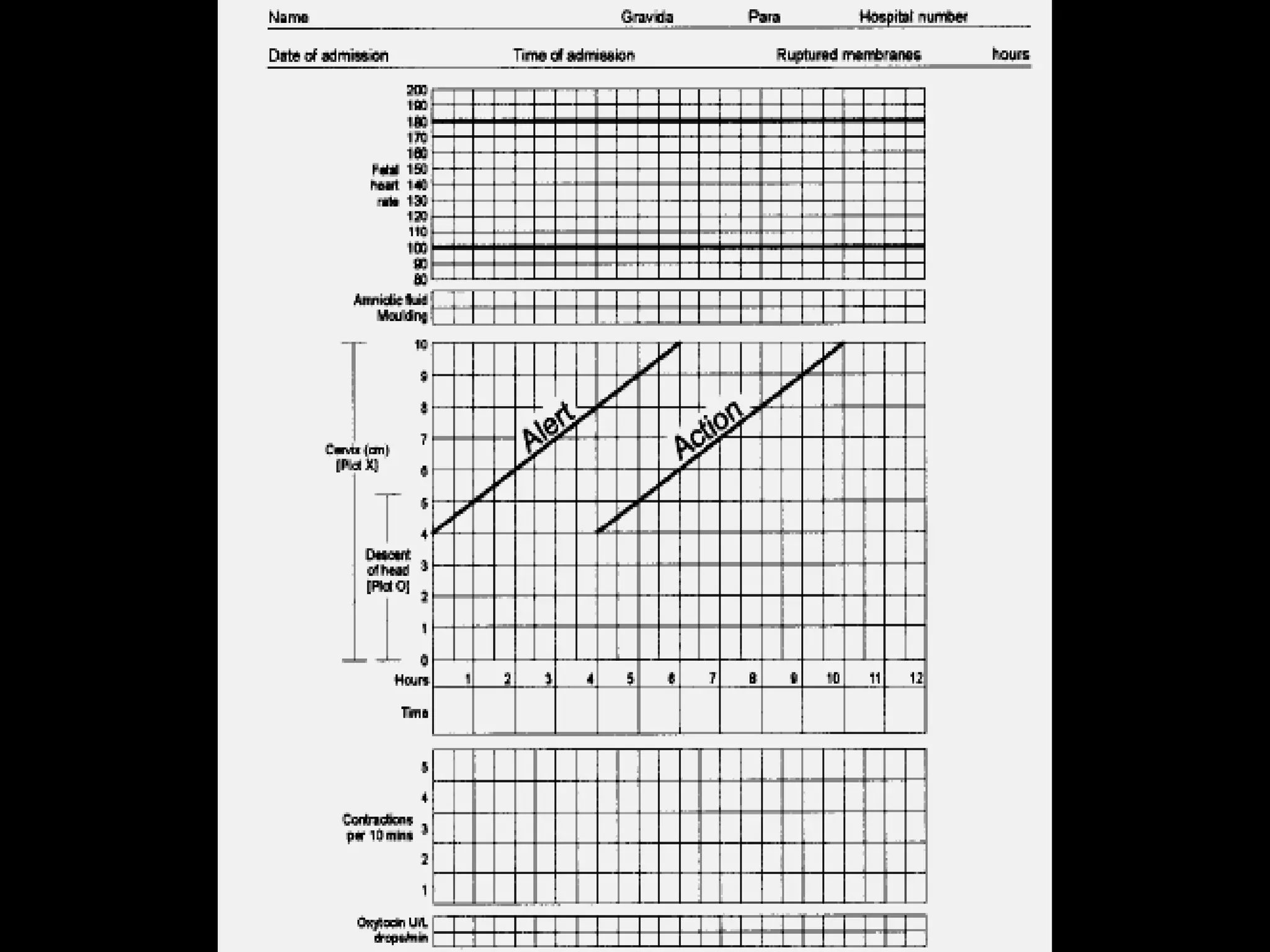 The partograph case tz | PPT