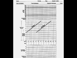 The partograph case tz | PPT