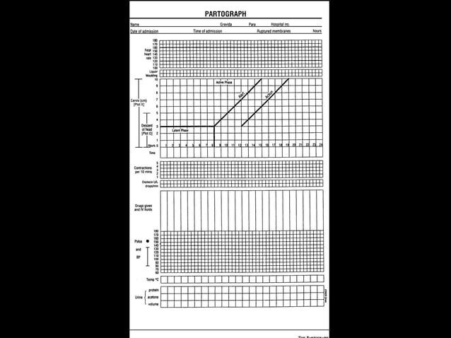 The partograph case tz | PPT | Free Download