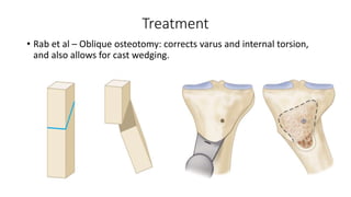 The pathology and management of blount’s disease | PPT