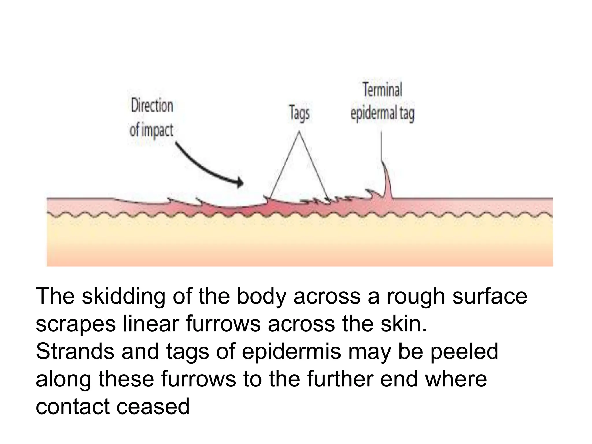 The Pathology of Wounds.pptx