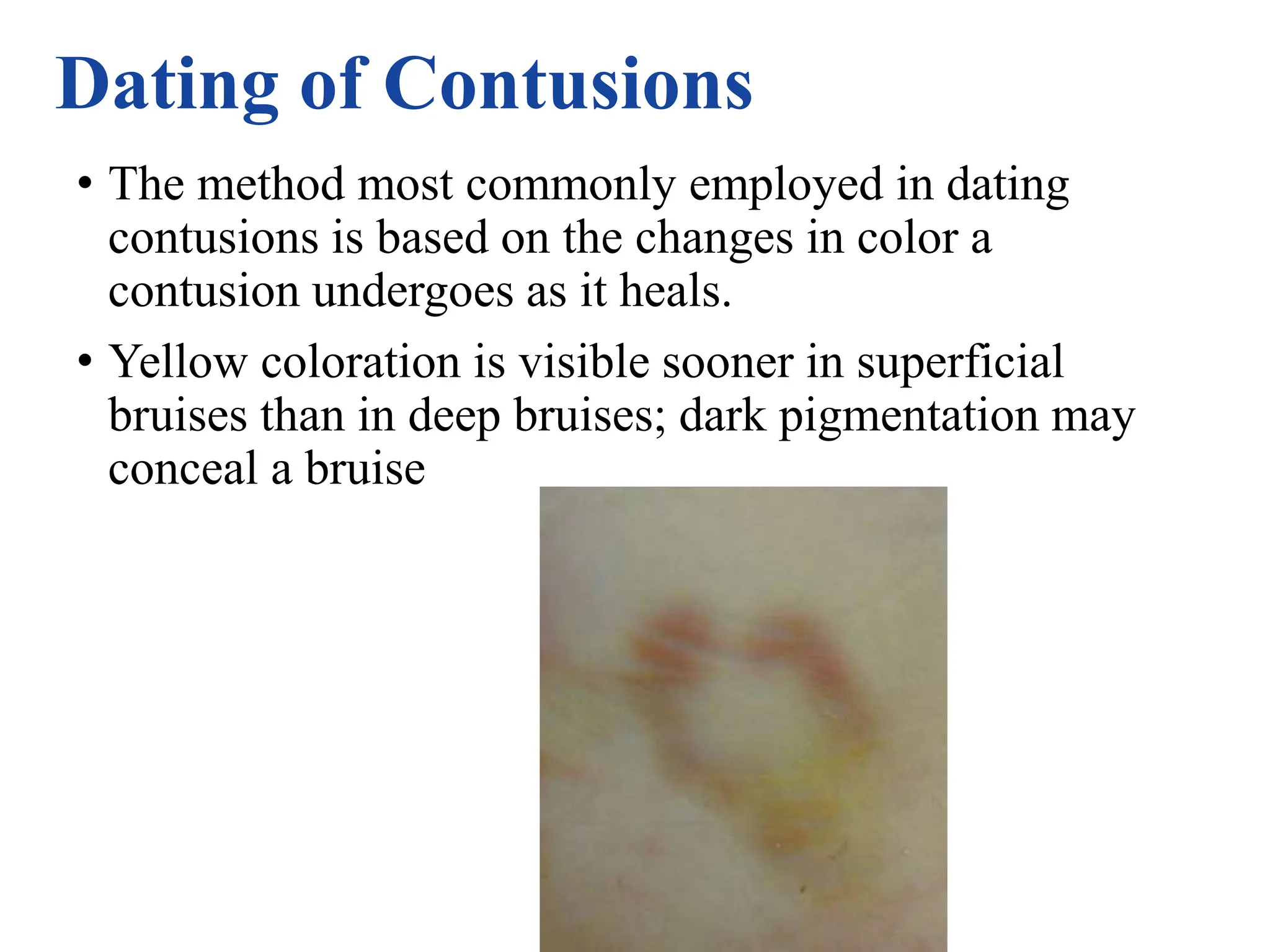 The Pathology of Wounds.pptx