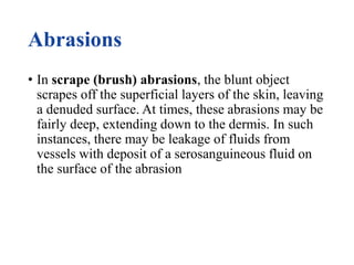 The Pathology of Wounds.pptx