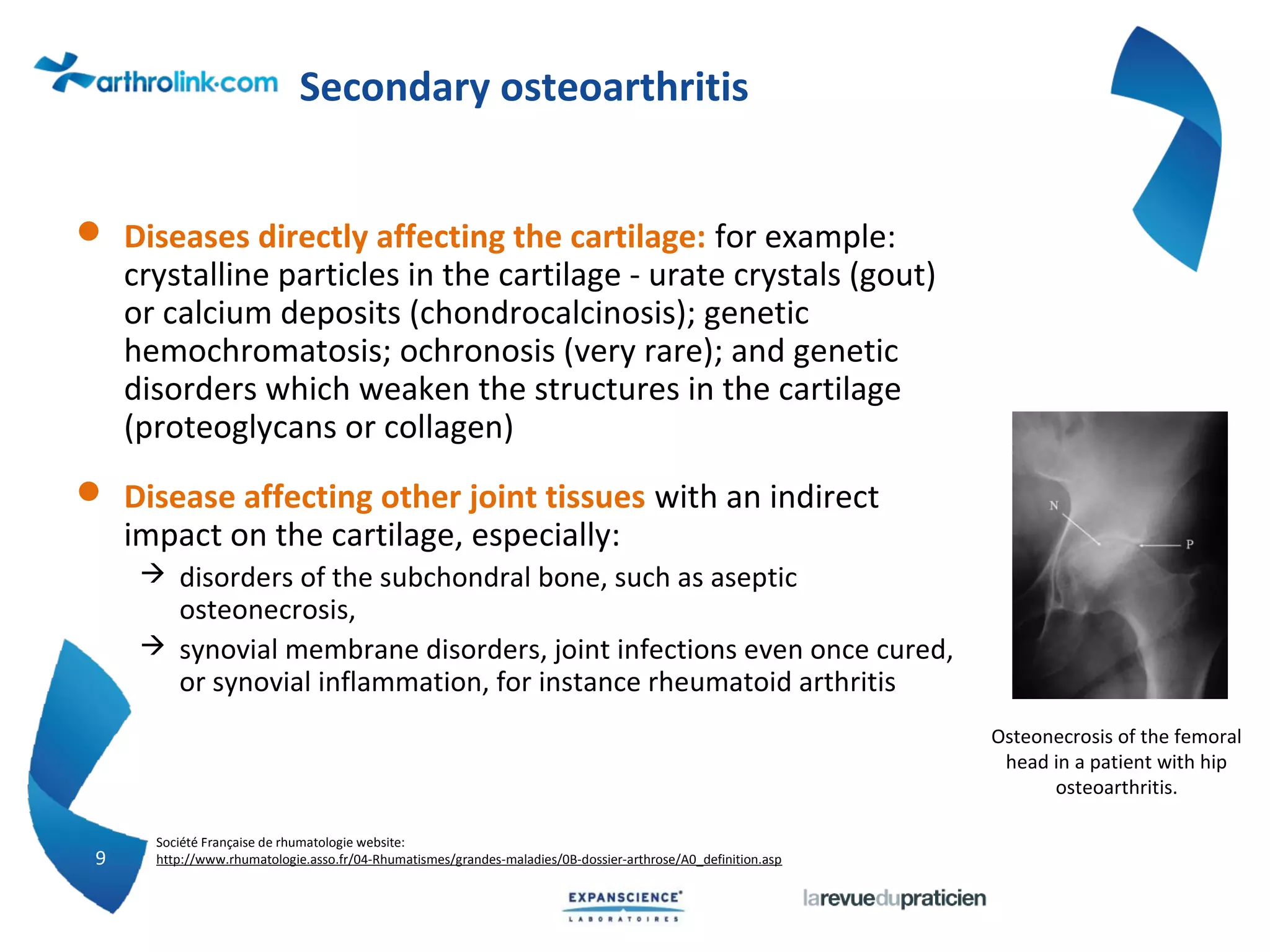 The pathophysiology of osteoarthritis | PPT